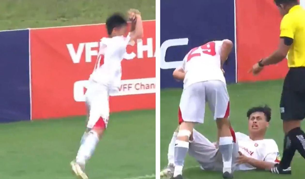 Futbolista imitó celebración de Cristiano y terminó lesionado